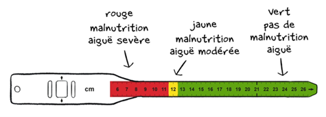 MUAC Bracelet to detect malnutrition - Nutriset